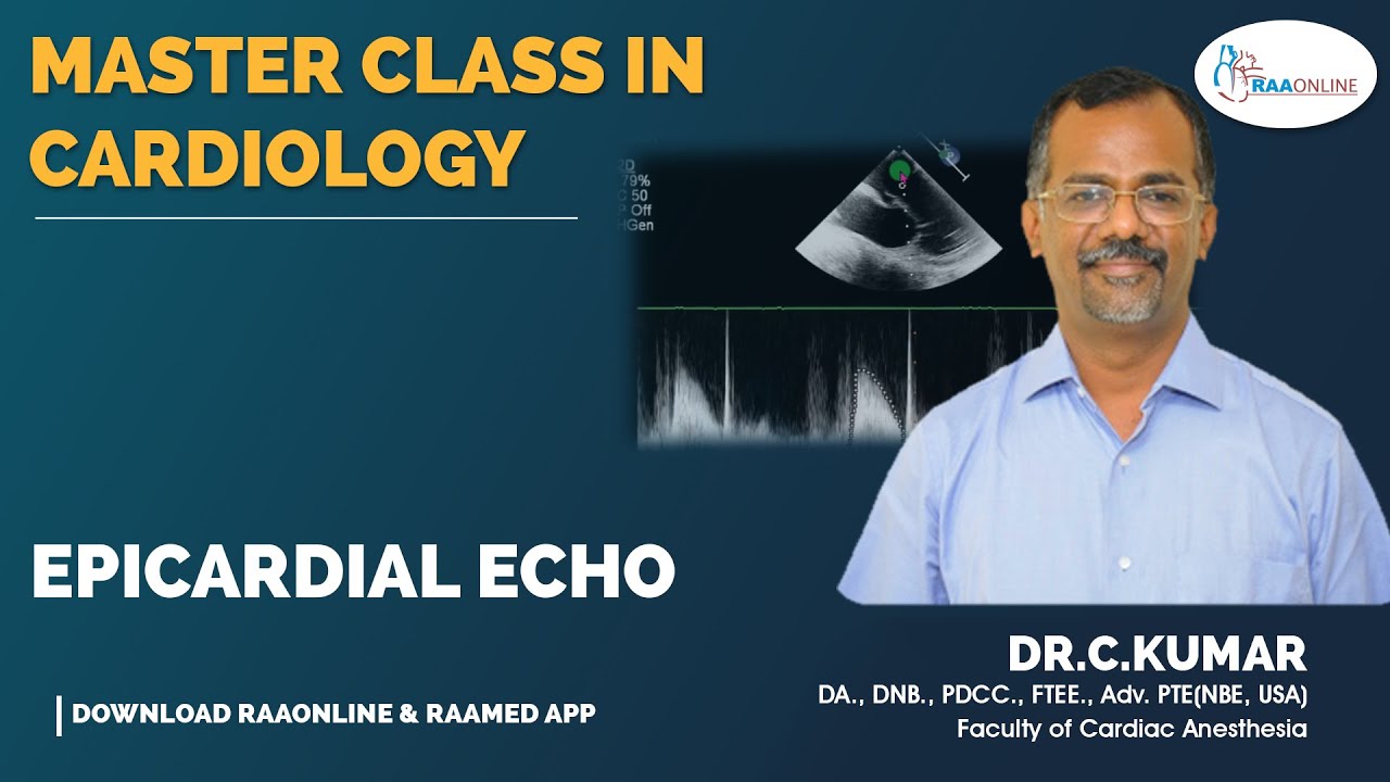 Master Class in Cardiology | Epicardial Echo | Raaonline #cardiology # ...
