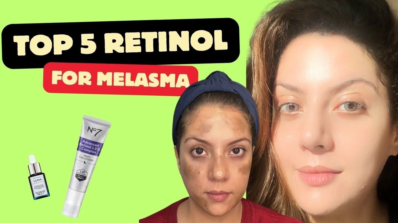 Best Retinol for Treating Melasma & Hyperpigmentation | Nipun Kapur ...
