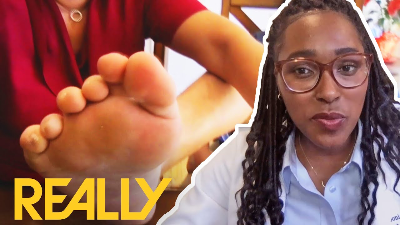 Teenager With Extra Toe Can't Wear Regular Shoes | My Feet Are Killing ...