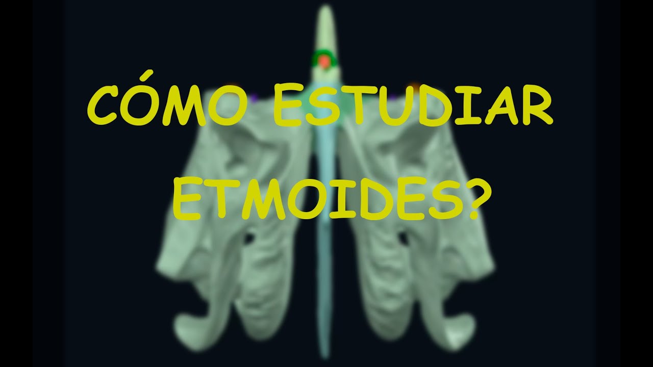 ETMOIDES.. FÁCIL O DIFÍCIL? - YouTube