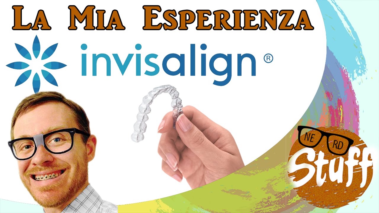 INVISALIGN ( ITA ) : La mia esperienza con l'apparecchio invisibile ...