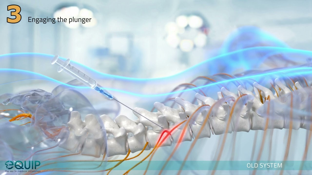 All-in-one PRF and RF thermocouple needle TOP NeuroPole pain management ...