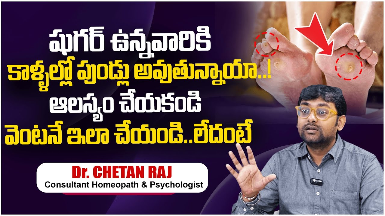 షుగర్ పేషెంట్స్ కాళ్ళల్లో పుండ్లు తగ్గాలంటే | How to Treat a Diabetic ...