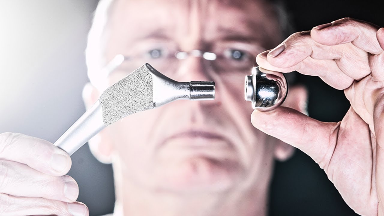 Hip Implants Causing SEVERE Metal Poisoning In Patients - YouTube