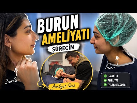 BURUN AMELİYATI SÜRECİ🏥#ailevlog burunameliyatı #ameliyat #vlog #rinoplasti 