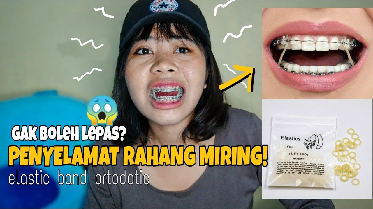 Cara Pakai & Fungsi ELASTIC BAND orthodontic untuk rahang gigi renggang ...