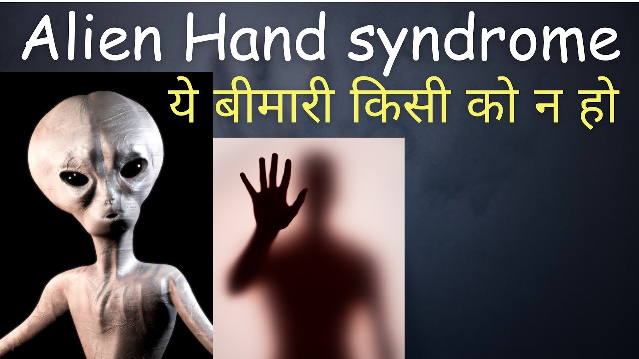 Alien hand syndrome | what is alien hand syndrome? | Alien hand ...