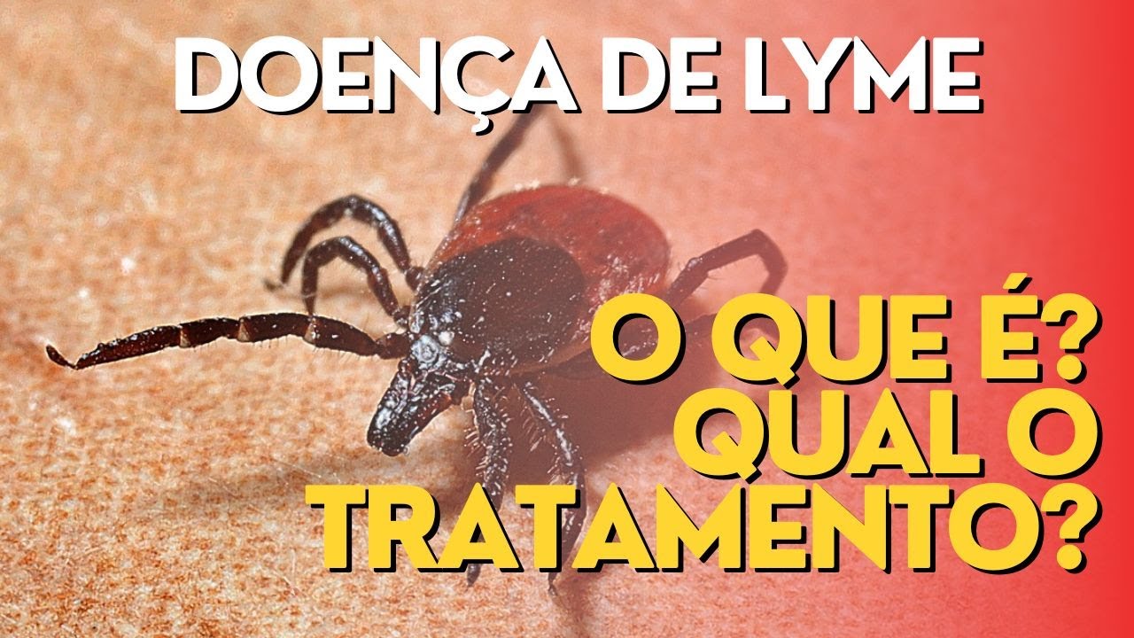 DOENÇA DE LYME: O QUE É, QUAIS OS SINTOMAS E QUAL O SEU TRATAMENTO ...