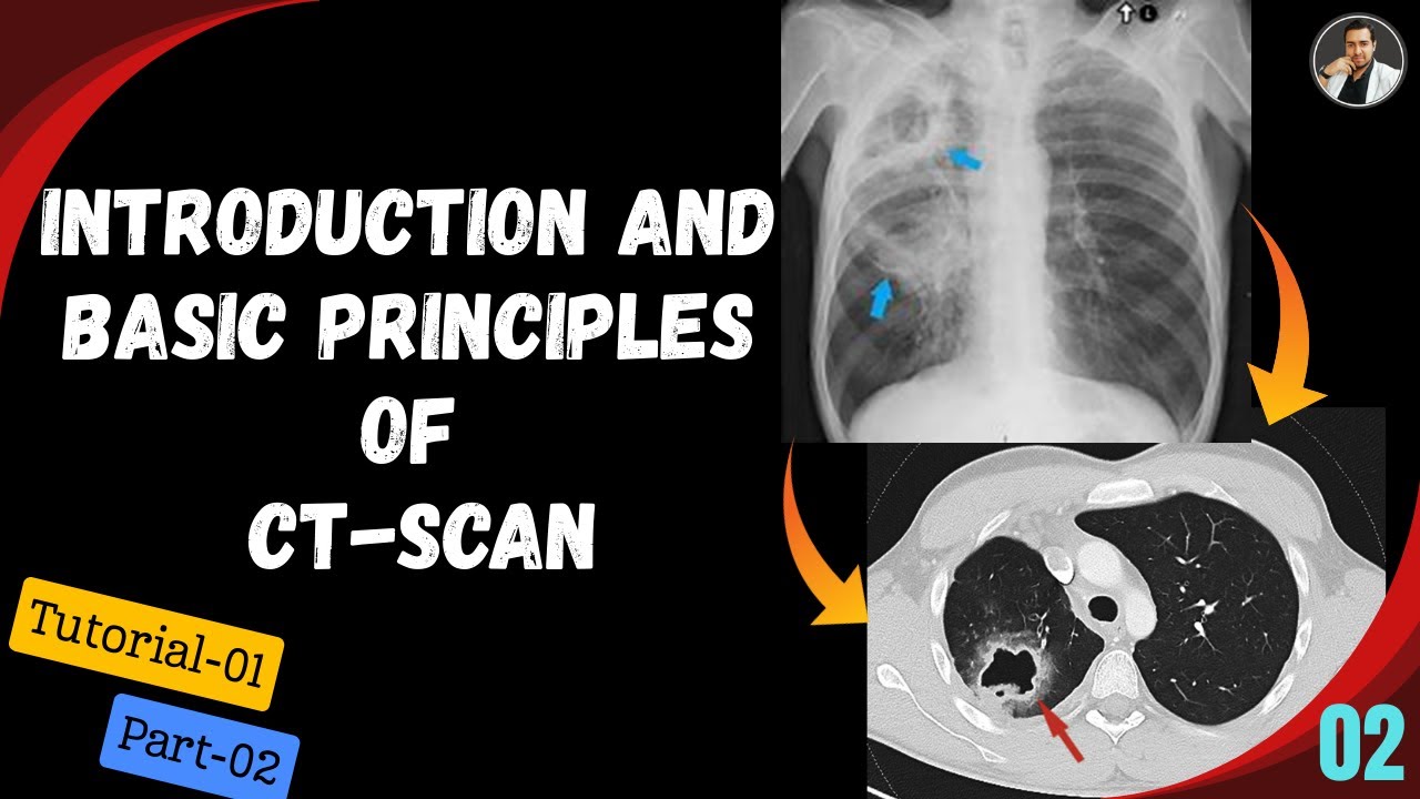 Introduction and basic principles of CT scan-Lecture 01(Part-02 ...