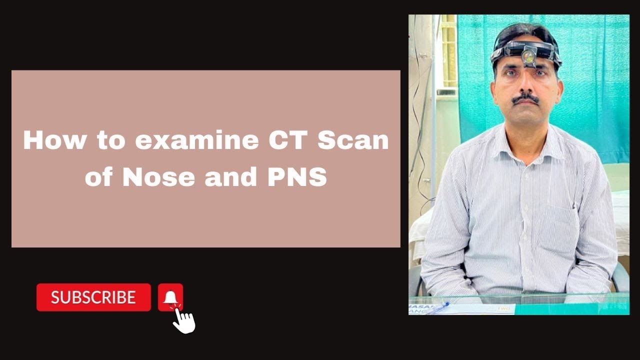 How to examine CT Scan of Nose and PNS | By Dr Maqsood Ahmed | ENT ...