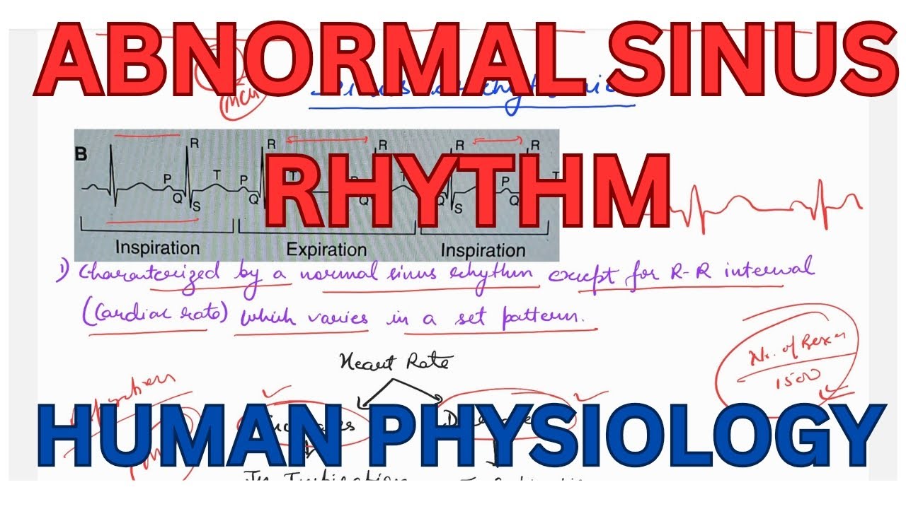 Abnormal sinus rhythm, sinus arrhythmia, sinus tachycardia, sinus ...