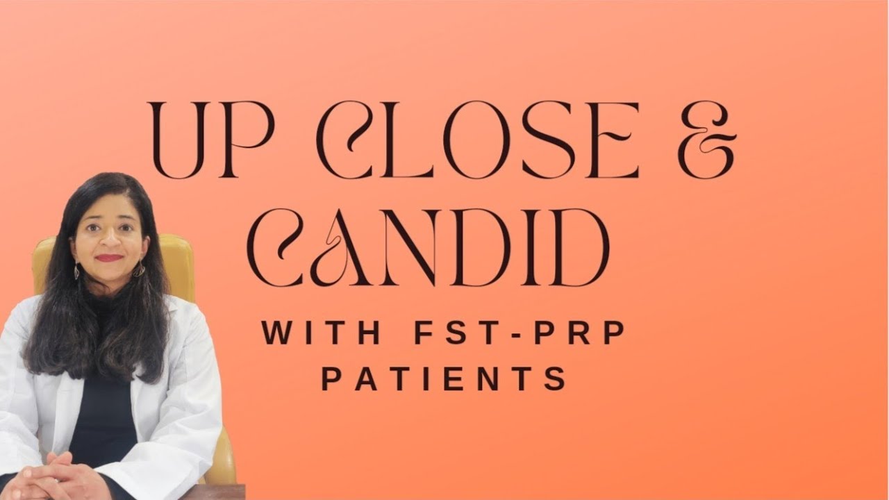 Up Close & Personal With My FST-PRP Patients | Hair Growth Journeys ...