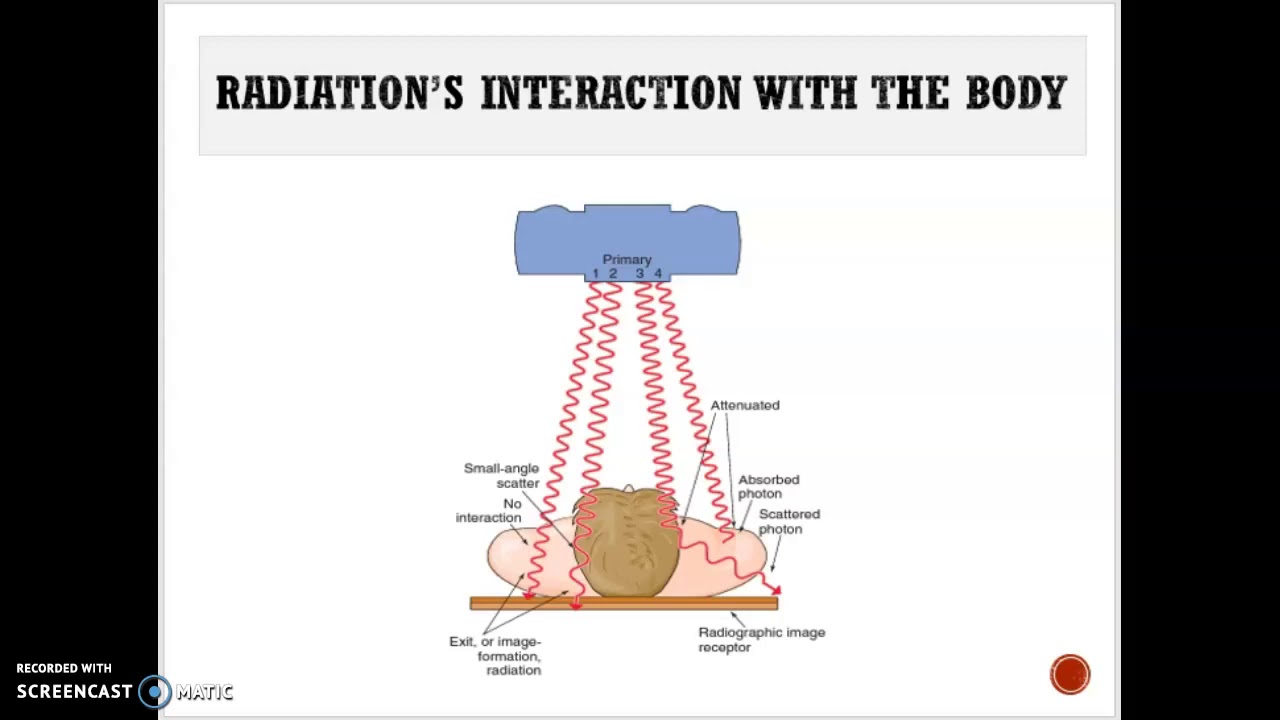 Radiation Interactions with the Body - YouTube