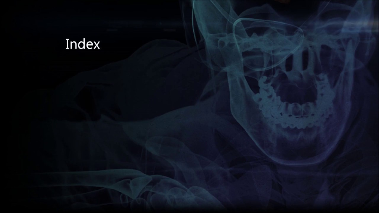 Snake X-Rays "Key Art" Posters by Kyle Cooper - Metal Gear Solid V ...