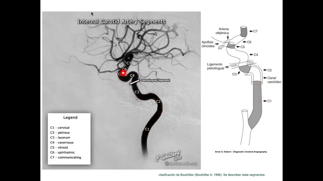 SNC vascular Arteria Carotida Interna 1 - YouTube