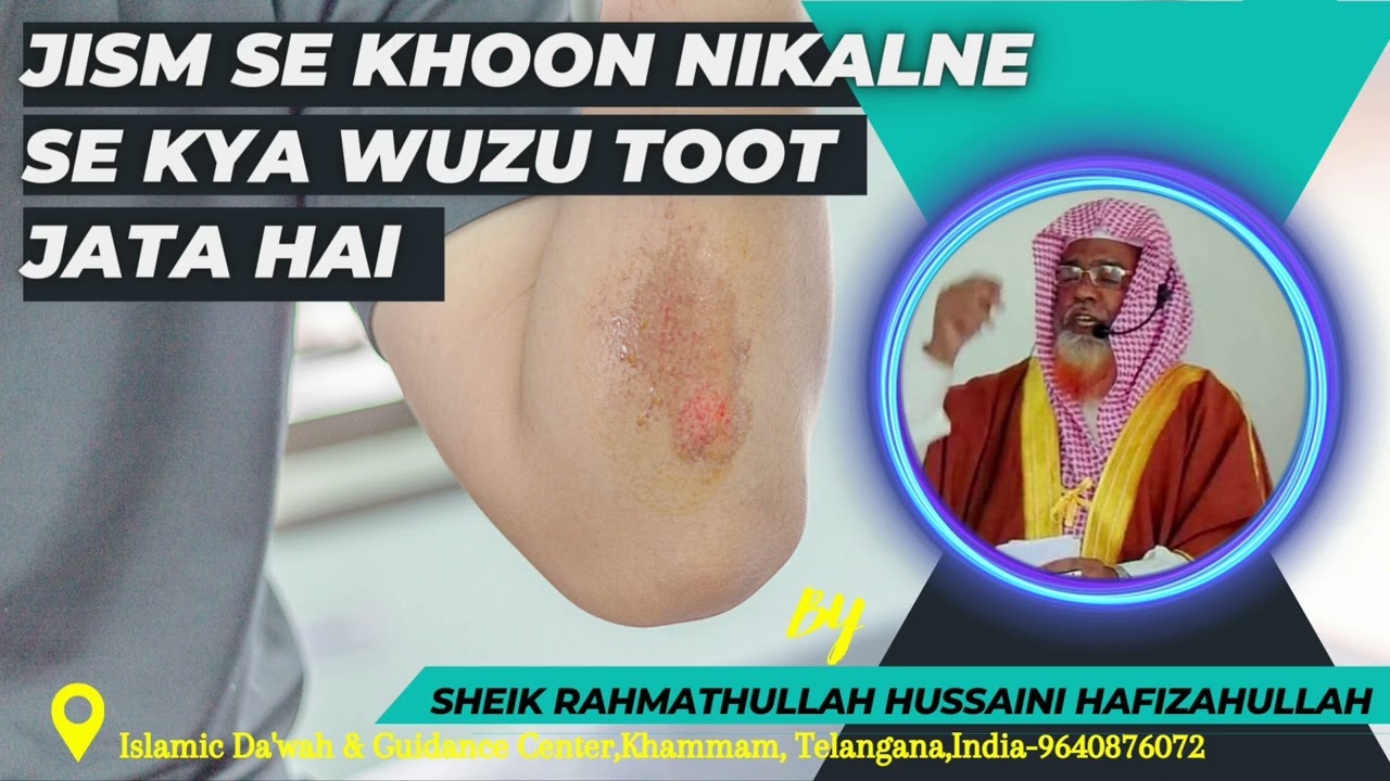 🔴💉Jism Se Khoon Nikalne Se Kya Wuzu Toot Jata Hai || By Sheik ...