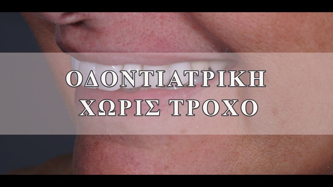 Όψεις ρητίνης χωρίς τρόχισμα. Οδοντιατρική χωρίς τροχό - YouTube
