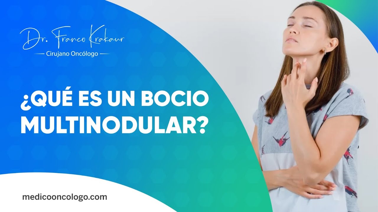 ¿Qué Es Un Bocio Multinodular? | Dr. Franco Krakaur | Cirujano Oncólogo ...