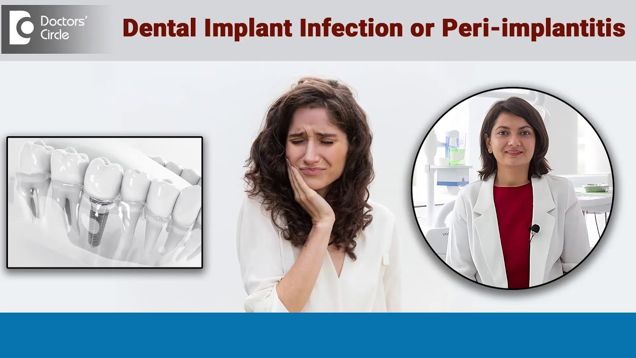 Warning Signs of Infection around Dental Implant | Peri-Implantitis -Dr ...