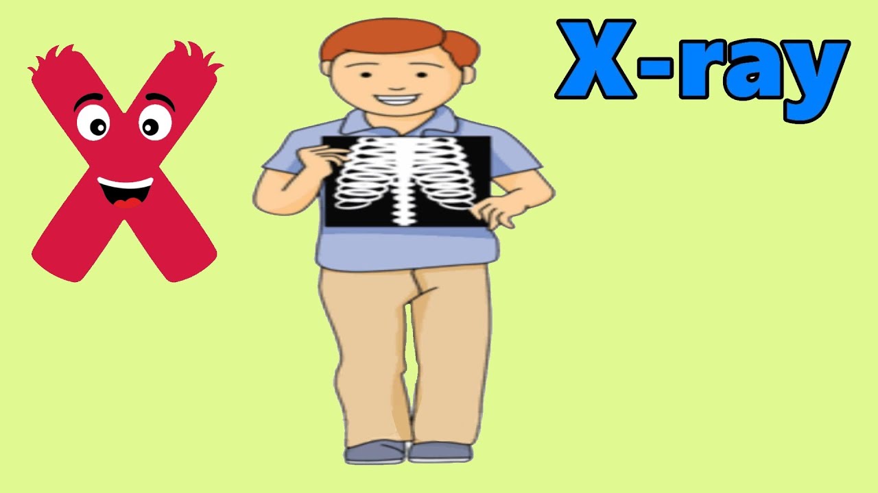 The Alphabet X Song | ABC Song with Animation | Phonic X Song ...