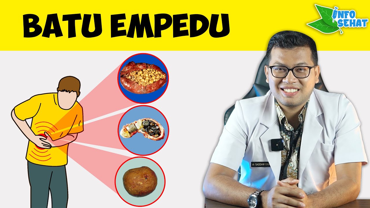 KUPAS TUNTAS PENYAKIT BATU EMPEDU - DOKTER SADDAM ISMAIL - YouTube