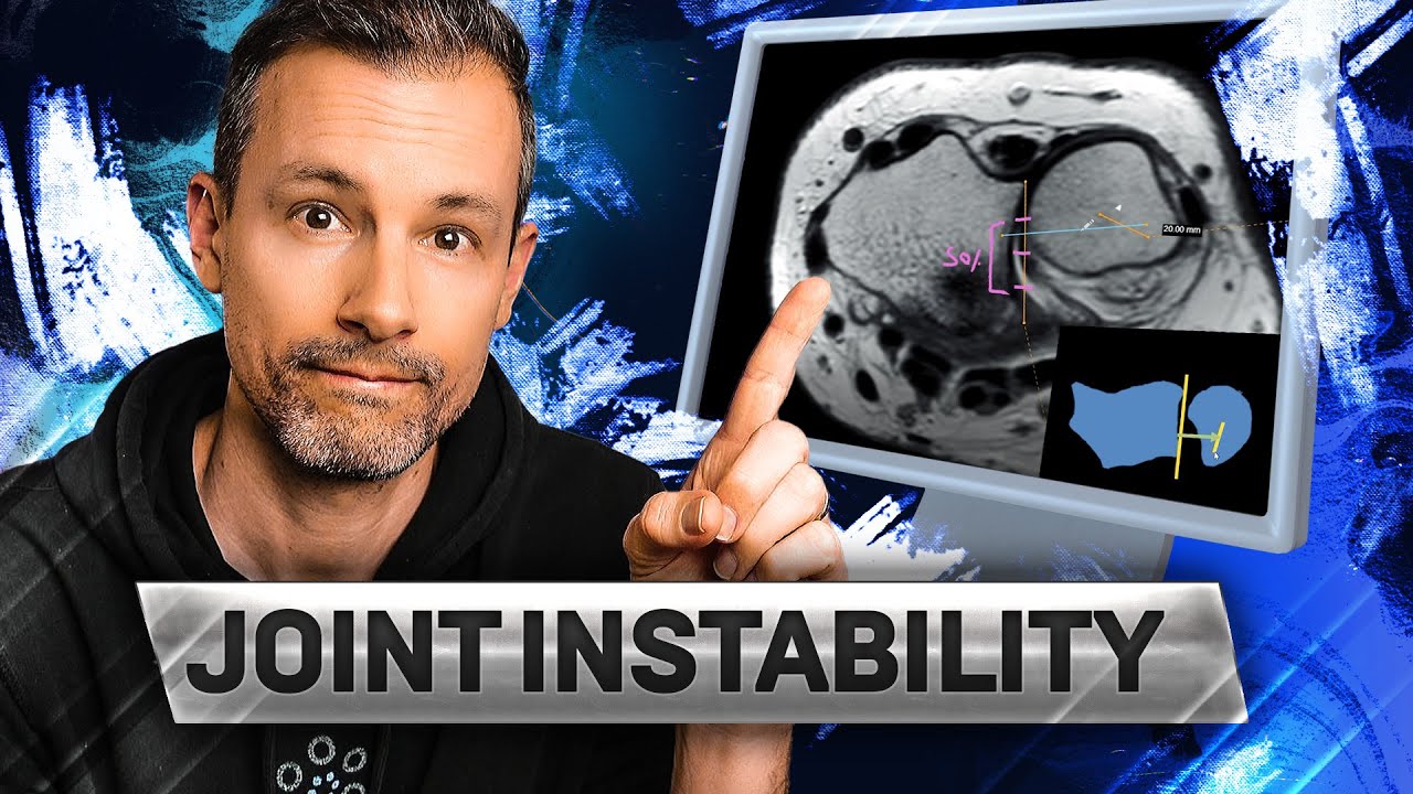 MRI of DRUJ Instability / Distal radioulnar joint instability ...