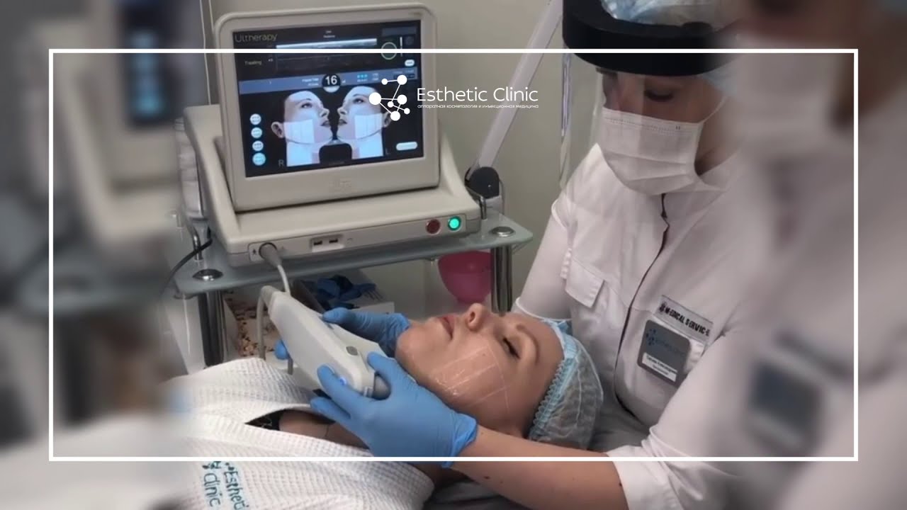 Безоперационная подтяжка АЛЬТЕРА СИСТЕМ (Ulthera System) - YouTube