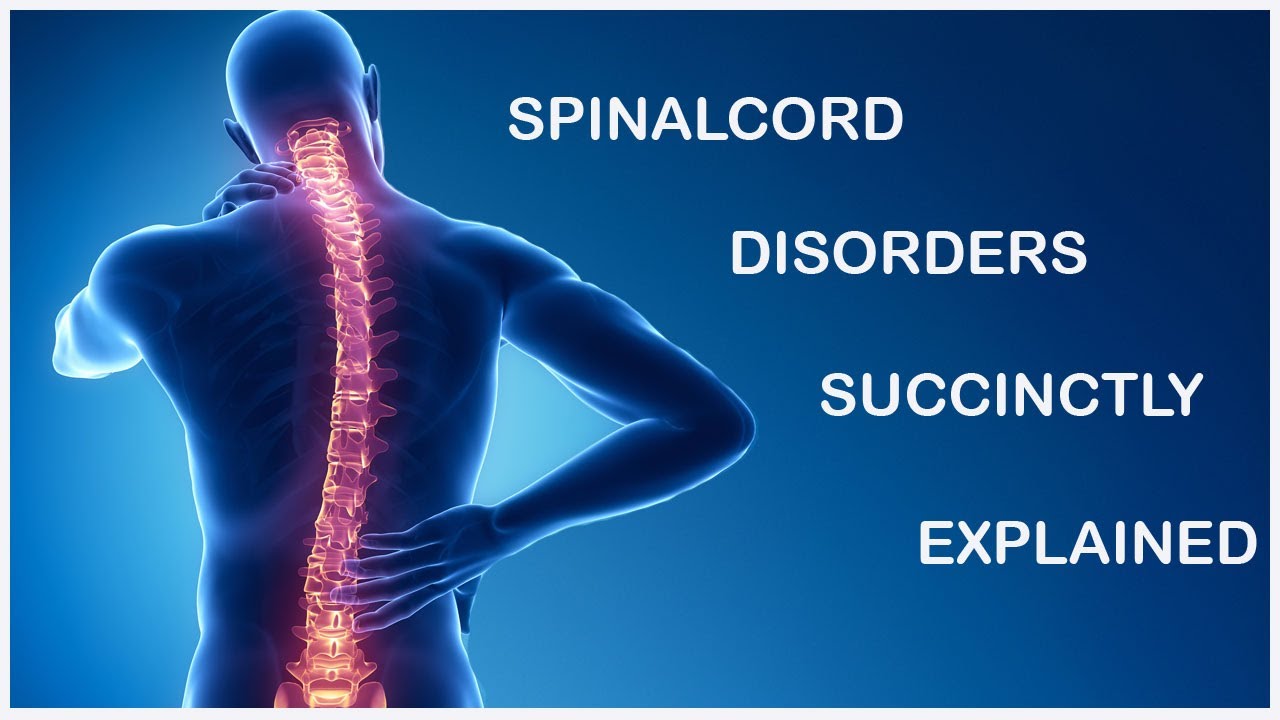 SPINALCORD DISORDERS SUCCINCTLY EXPLAINED - YouTube