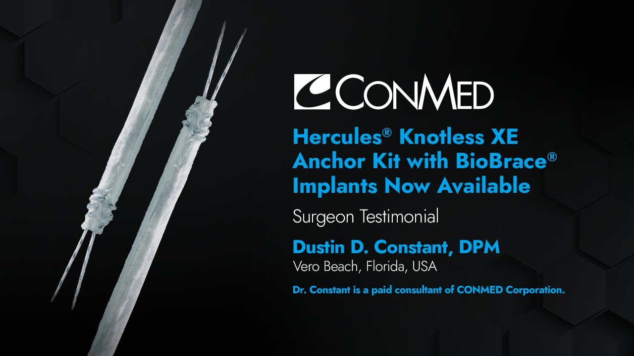 Hercules® Knotless XE Anchor Kit with BioBrace® Implant - Dustin D ...
