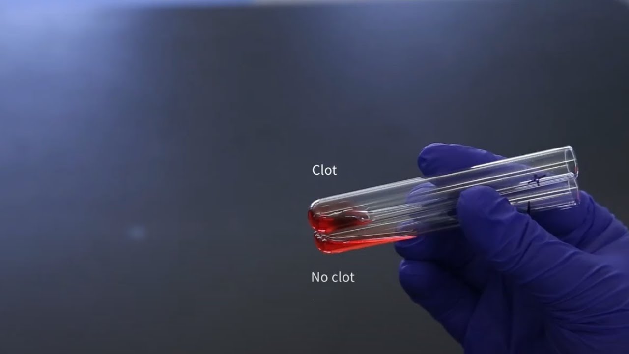 Soleris® Training | S2-SA Confirmation Testing - YouTube