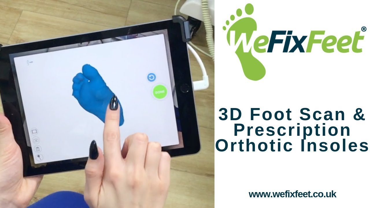 3D Foot Scanning and Manufacture of Bespoke Prescription Orthotic ...