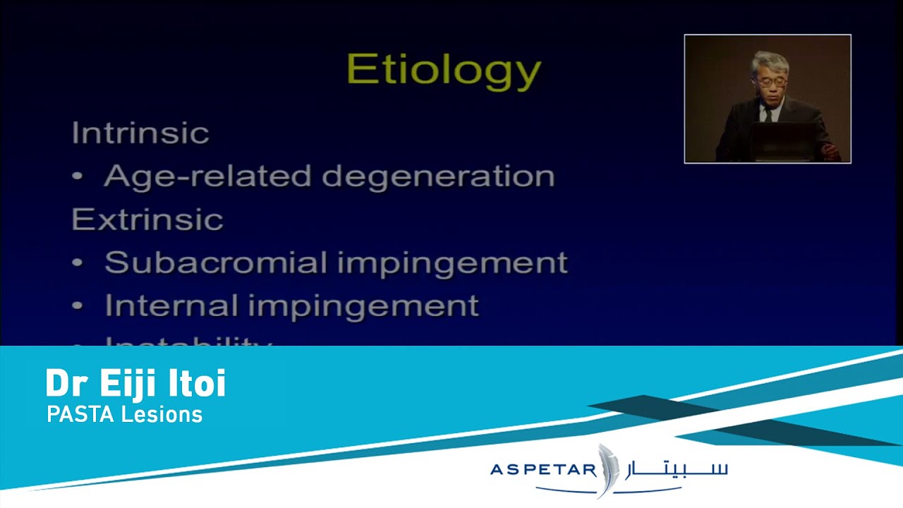PASTA Lesions by Dr Eiji Itoi - YouTube