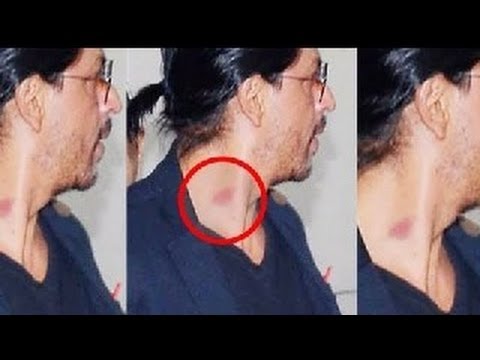 Biting Neck Love
