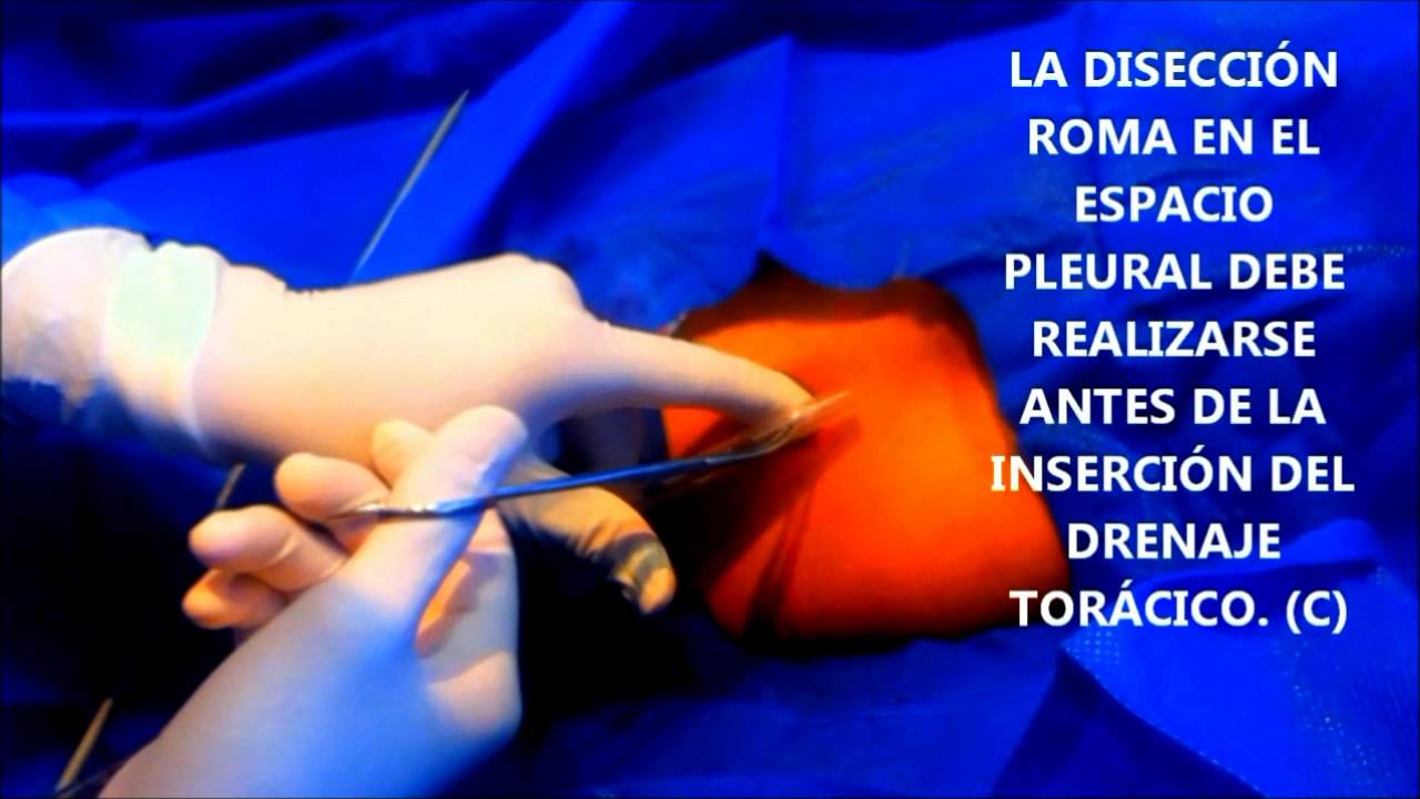 Colocacion de Tubo Toracico - YouTube