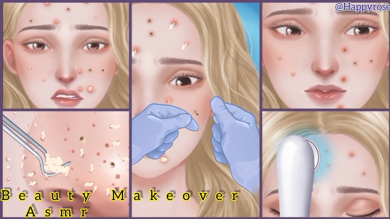 Ache Black Heads And Pimple Removal Asmr Video 🌹 #youtube #viral # ...