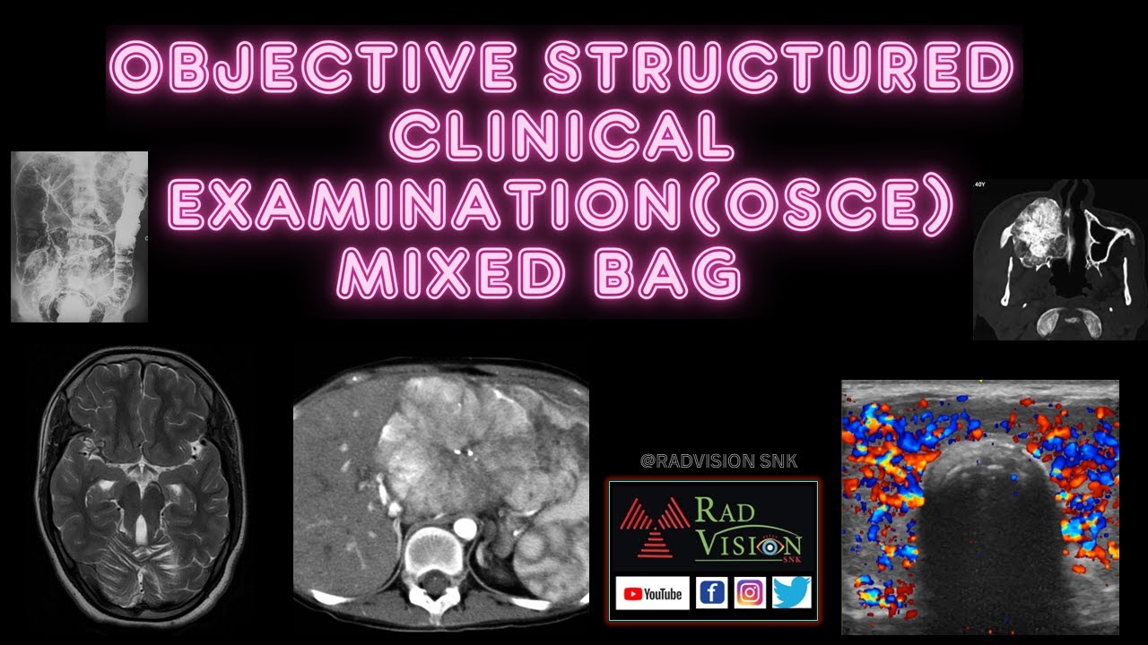EXAM GOING STUDENTS OSCE MIXED BAG SET II - YouTube