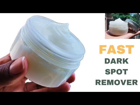 ONLY 3 INGREDIENTS FOR DARK SPOT REMOVAL | Smooth Skin| homemade face ...