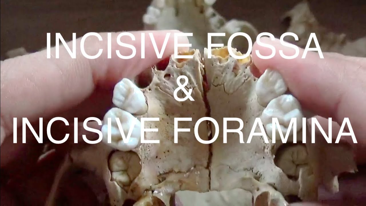 Incisive Fossa Of Maxilla