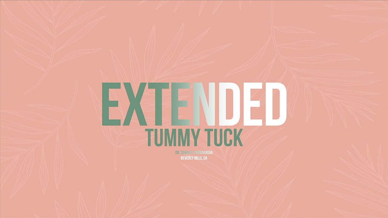 Extended Tummy Tuck - YouTube