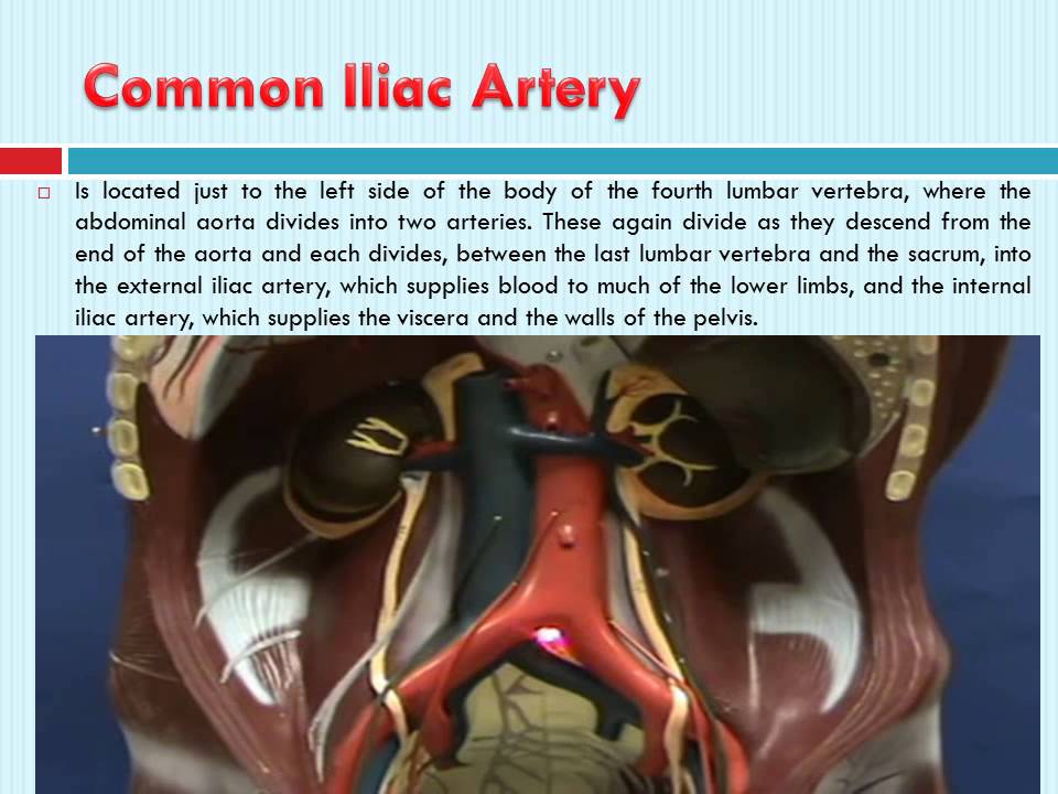 Iliac Artery