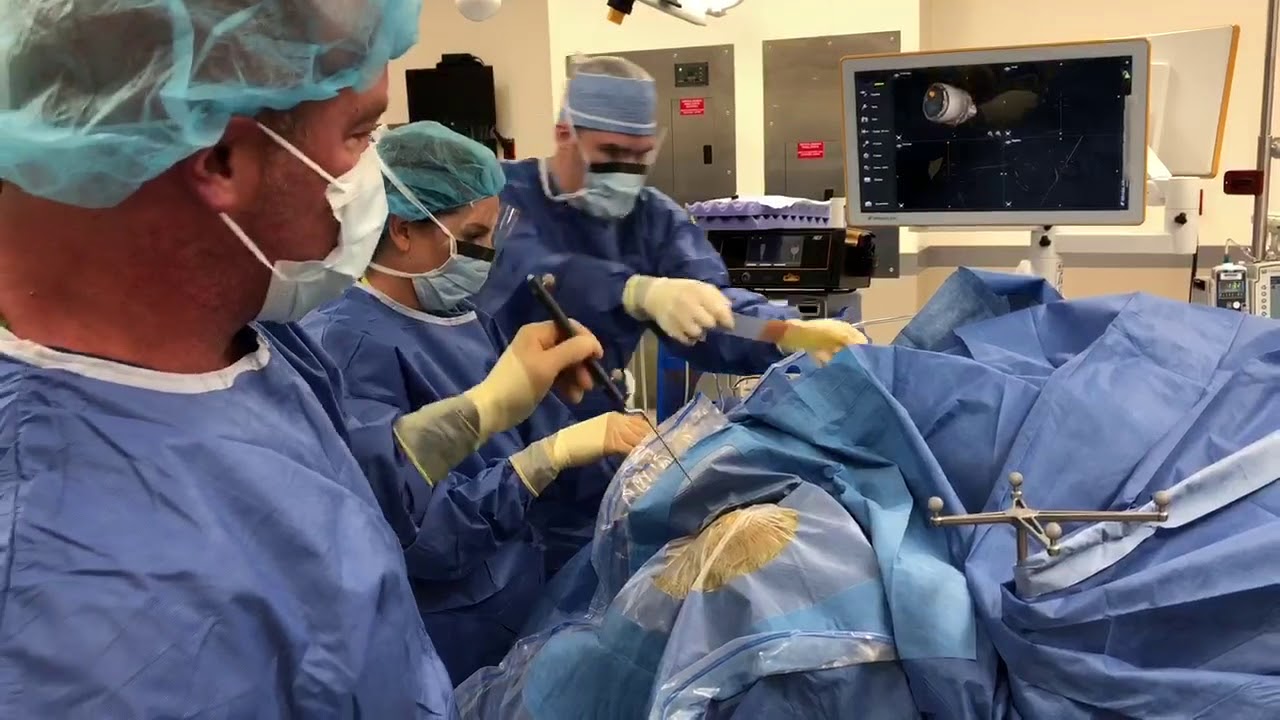 #SurgeryDay: Left Craniotomy of Parietal Mass with Dr. Dickerman - YouTube