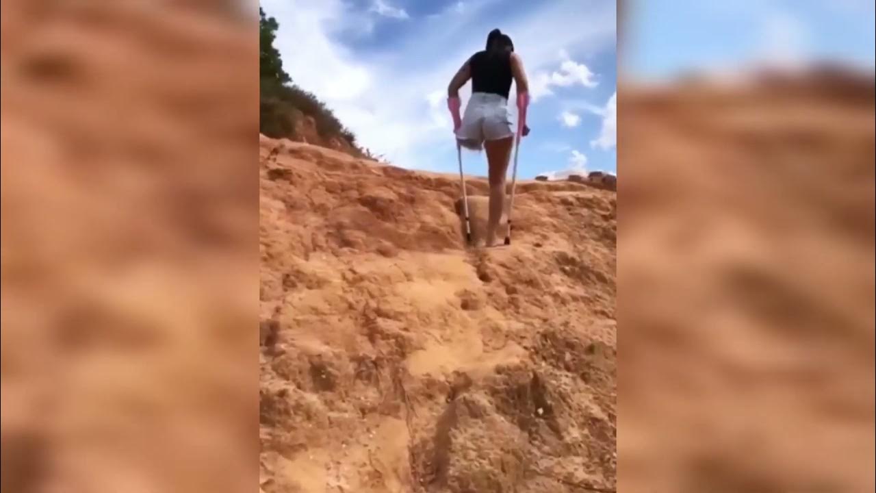 Polio Sex Love Amputee Sexy Girl Walking With Crutches π¦΅π»π―π₯° Youtube