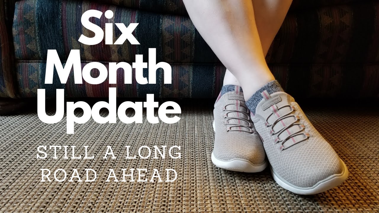 Ankle Injury SIX MONTH UPDATE | Syndesmotic Disruption, Torn Ligaments ...