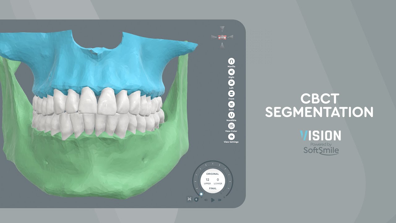 What is CBCT segmentation? A 3D Visual Walkthrough - YouTube