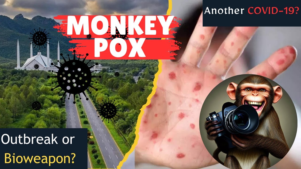 Monkey Pox/ M pox in Pakistan?| Symptoms | Treatment & Prevention| Outbreak. - YouTube