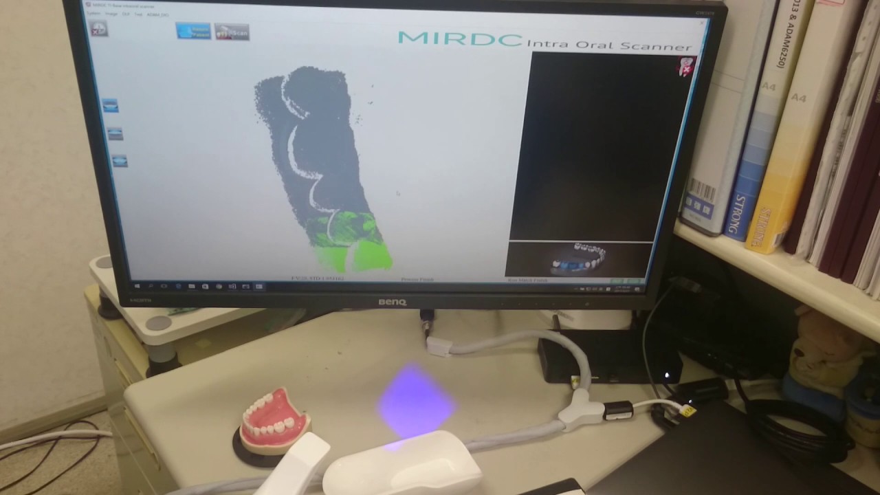 intra-oral scanner testing in continuous capture mode (1) - YouTube