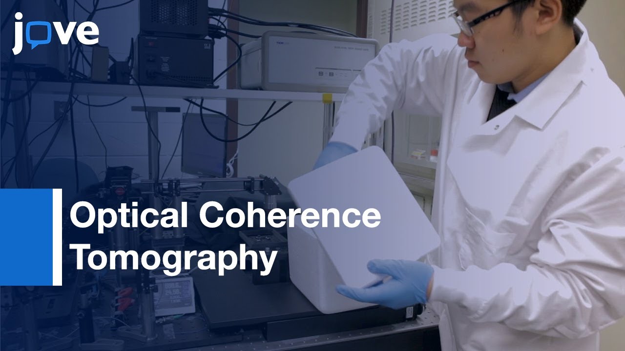 3D Tumor Spheroids Characterization by Optical Coherence Tomography ...