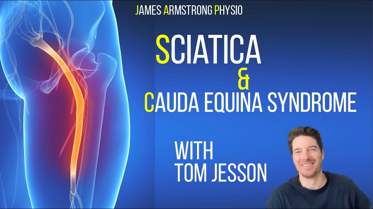 Understanding Sciatica and Cauda Equina Syndrome with Tom Jesson - YouTube