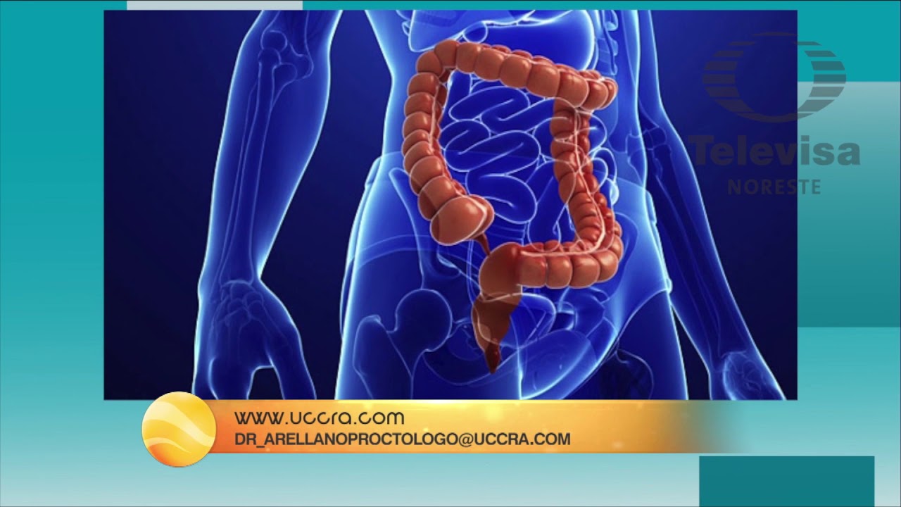 Tumores en el intestino delgado | UCCRA - YouTube
