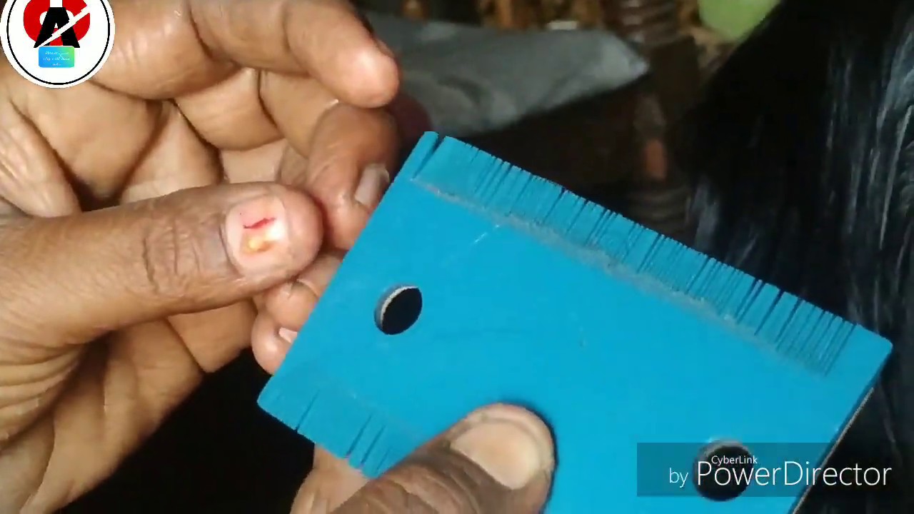 head nits and lice pick for long hair nitpicking / nits and lice dead ...